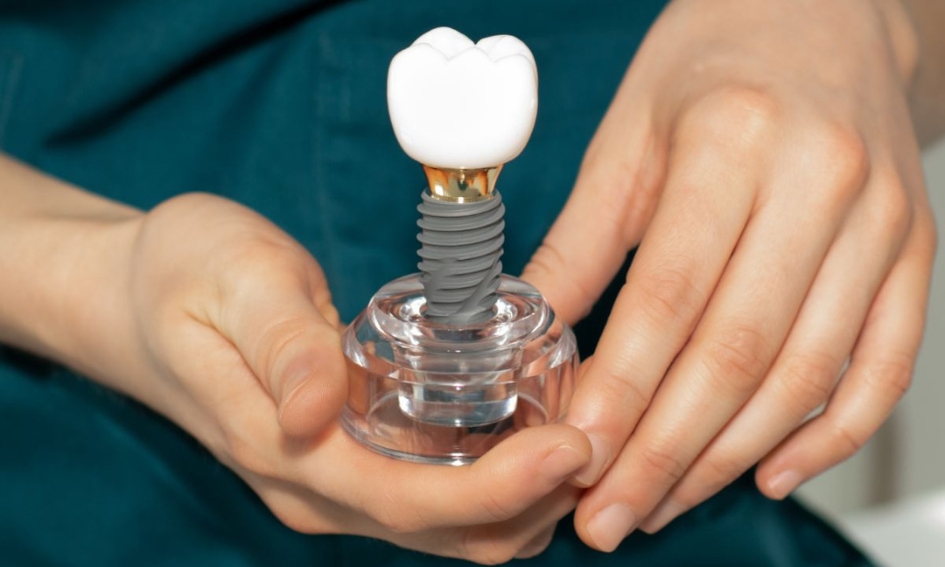 Dental Implants for Older Adults: Age & Health Concerns